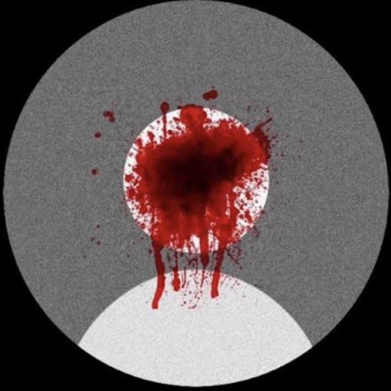 tony 🩻 (@a.fiore25) | Snapchat Stories, Spotlight & Lenses