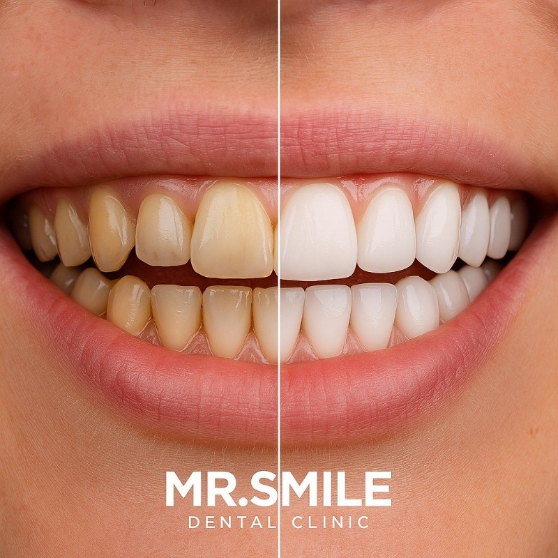 Dt Ismail Nasser 🦷 (@dtismailnasser) | Snapchat Stories, Spotlight & Lenses