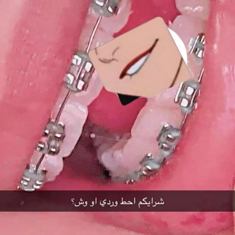 . (@kfj-ja) | Snapchat Stories, Spotlight & Lenses