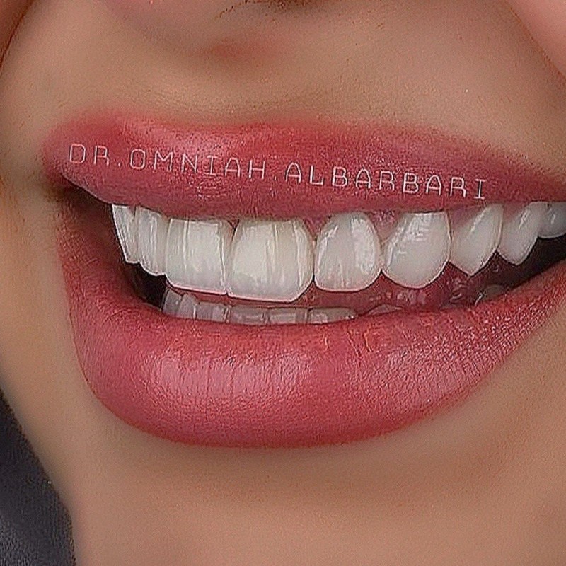 د.امنيه البربري طبيبه اسنان (@omniah-msy) | Snapchat Stories, Spotlight & Lenses