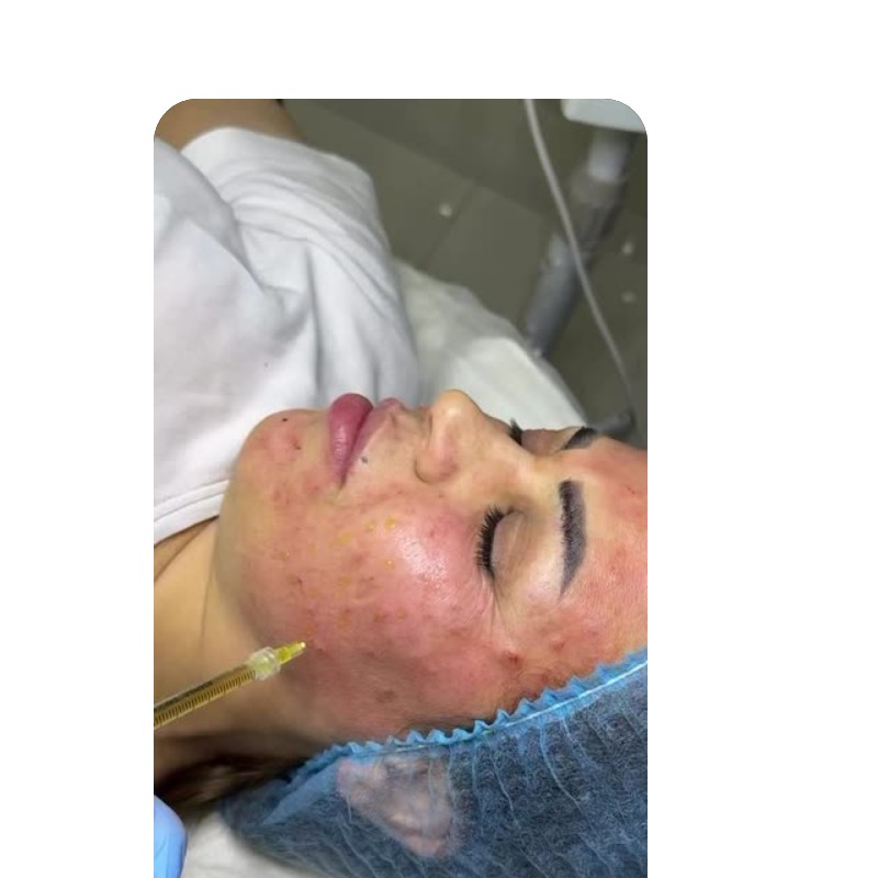 Urfa BeautyCenter (@urfa_beauty) | Snapchat Stories, Spotlight & Lenses